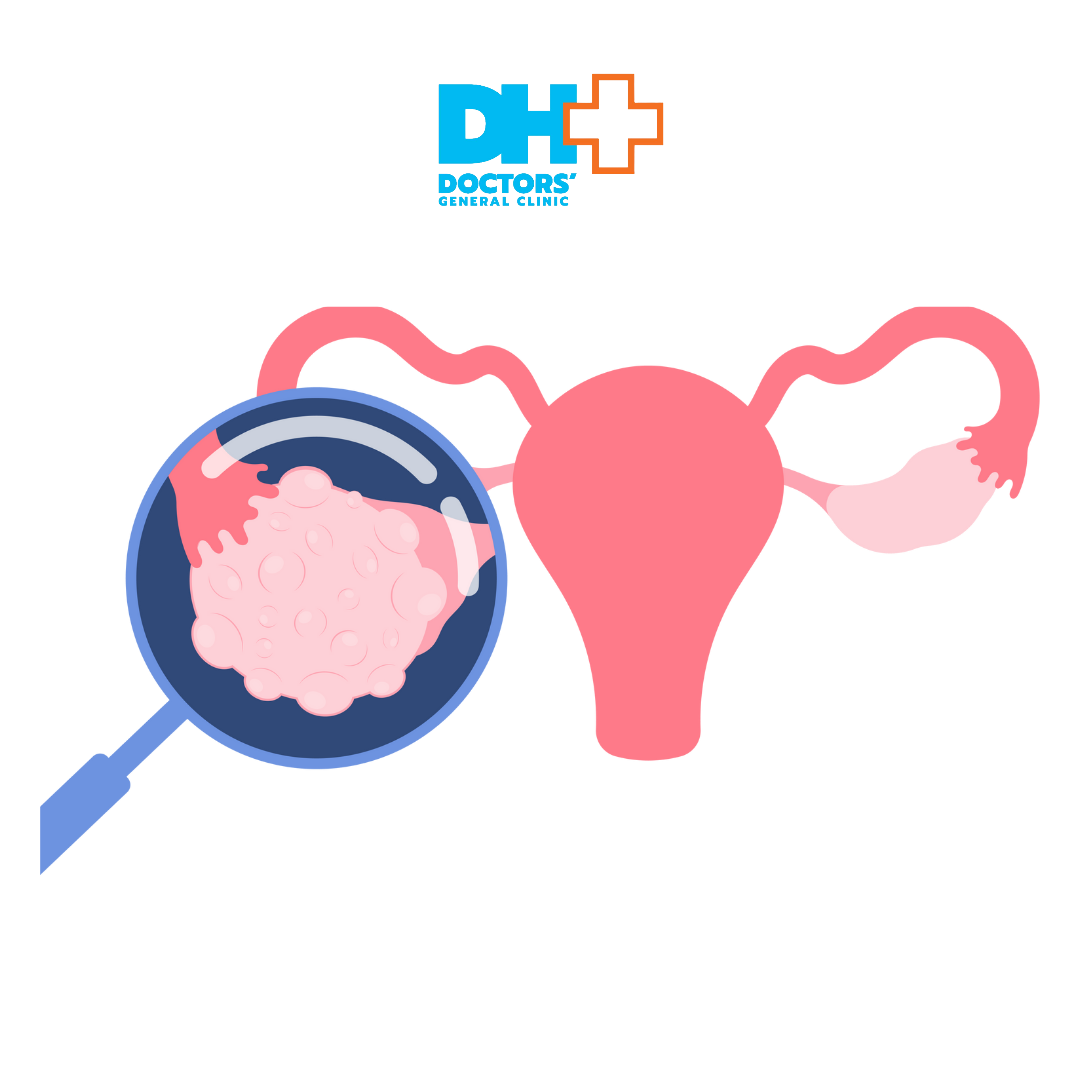 Καρκίνος Ωοθηκών - Doctors' General Clinic