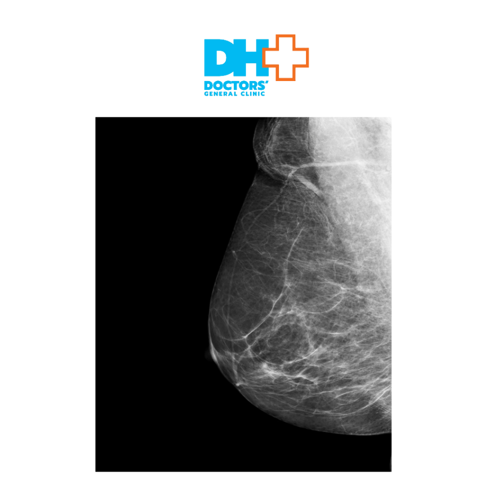 Καρκίνος Μαστού - Doctors' General Clinic